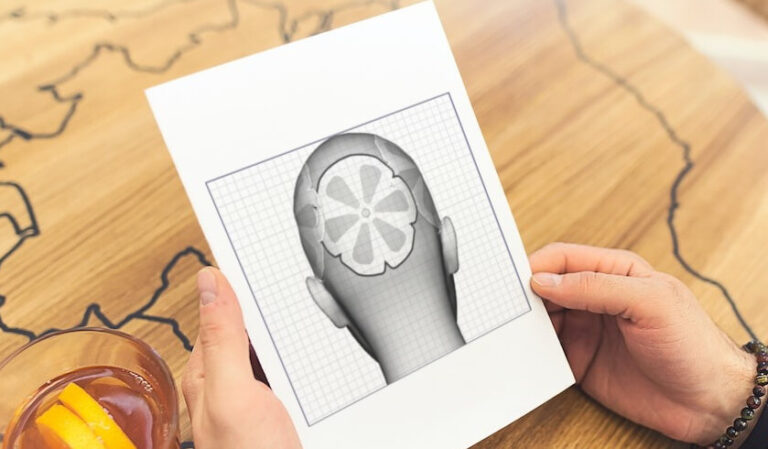 Wie bekomme ich Optune? Wer übernimmt die Kosten von Optune?
