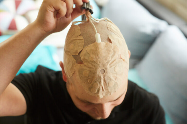 Glioblastom und Astrozytom Grad 4 Therapien | Optune.de